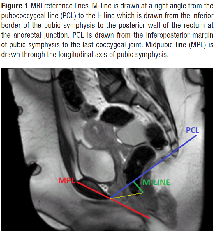 The association of MRI defined pelvic organ descent with urinary ...